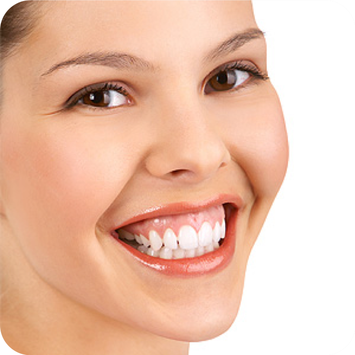 Gummy Smile Correction – British Aesthetic Academy